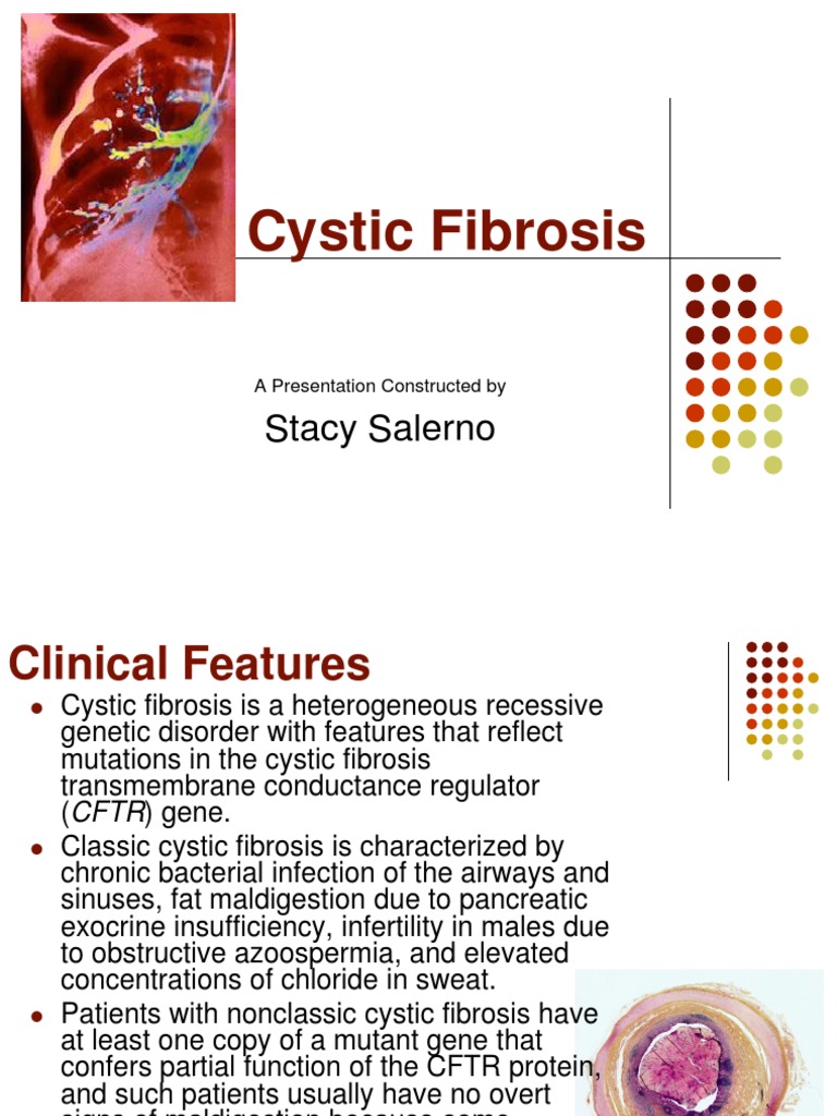 Understanding the Molecular Basis and Clinical Presentation of Cystic ...