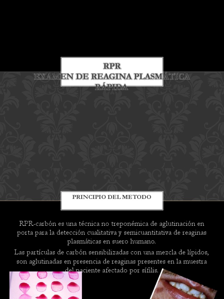 RPR Examen De Reagina Plasmática Rápida