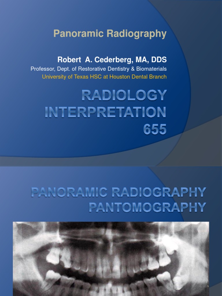 Panoramic Radiography Overview | PDF | Radiography | Human Head And Neck