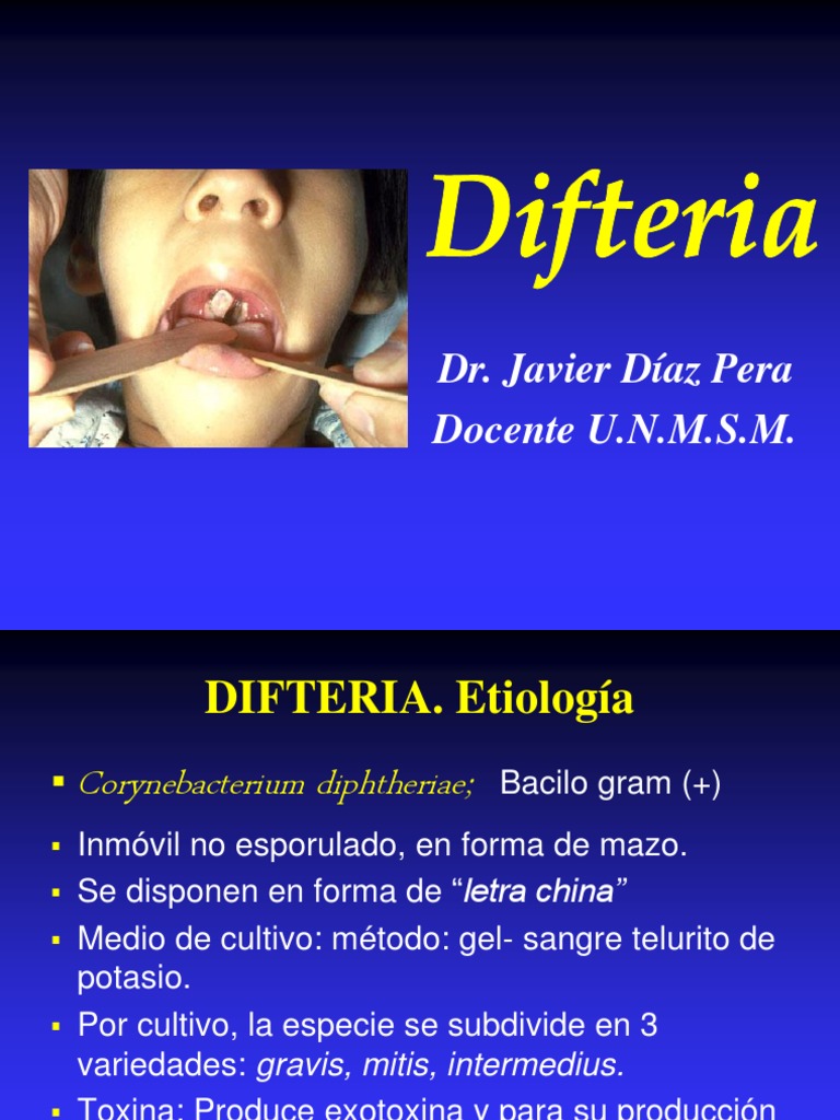 Difteria: Etiología, Epidemiología y Tratamiento | PDF | Microbiología ...