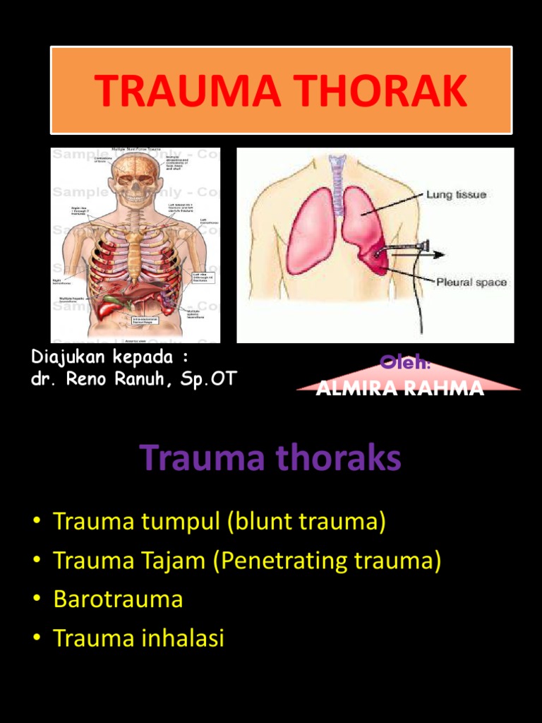 Trauma Thorak | PDF