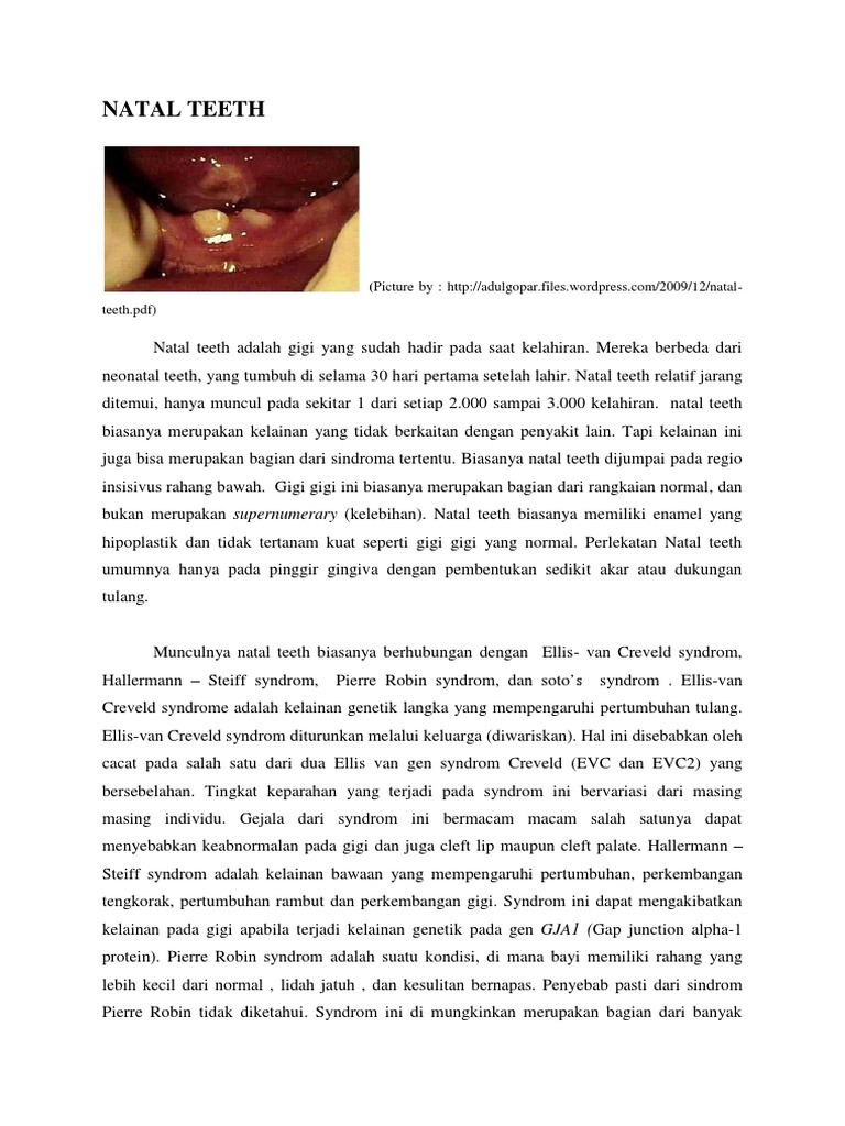 Natal Teeth | PDF | Kesehatan Holistik