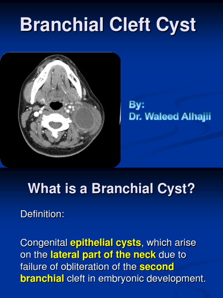 Second Branchial Cleft Cyst Overview | PDF | Neck | Neoplasms