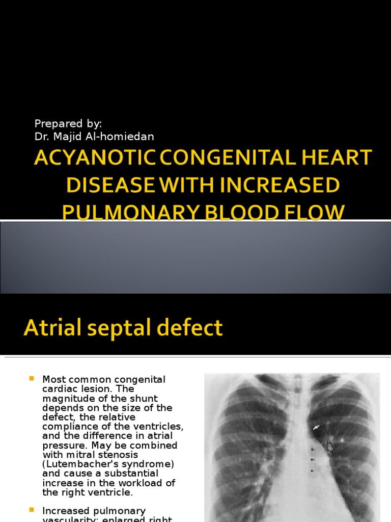 Acyanotic Congenital Heart Disease With Increased Pulmonary Blood Flow ...