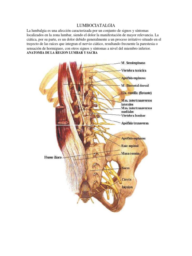 Lumbociatalgia: Síntomas y Tratamientos | PDF | Dolor lumbar | Rtt