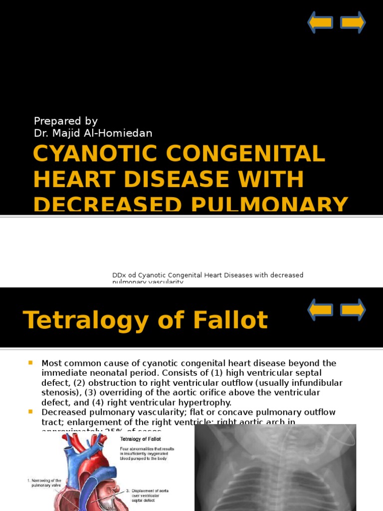 Cyanotic Congenital Heart Disease With Decreased Pulmonary Blood Flow ...