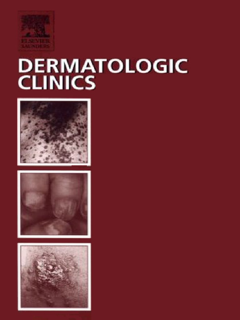 2006, Vol.24, Issues 2, Women's Dermatology | PDF | Acne Vulgaris ...
