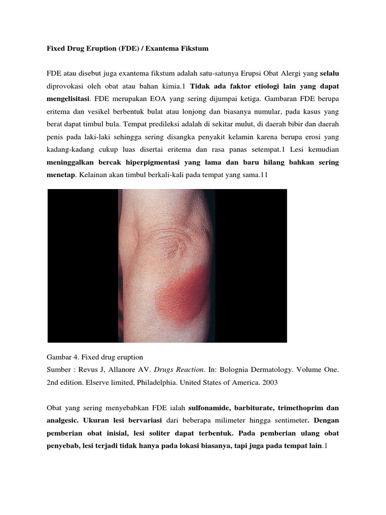 Fixed Drug Eruption | PDF