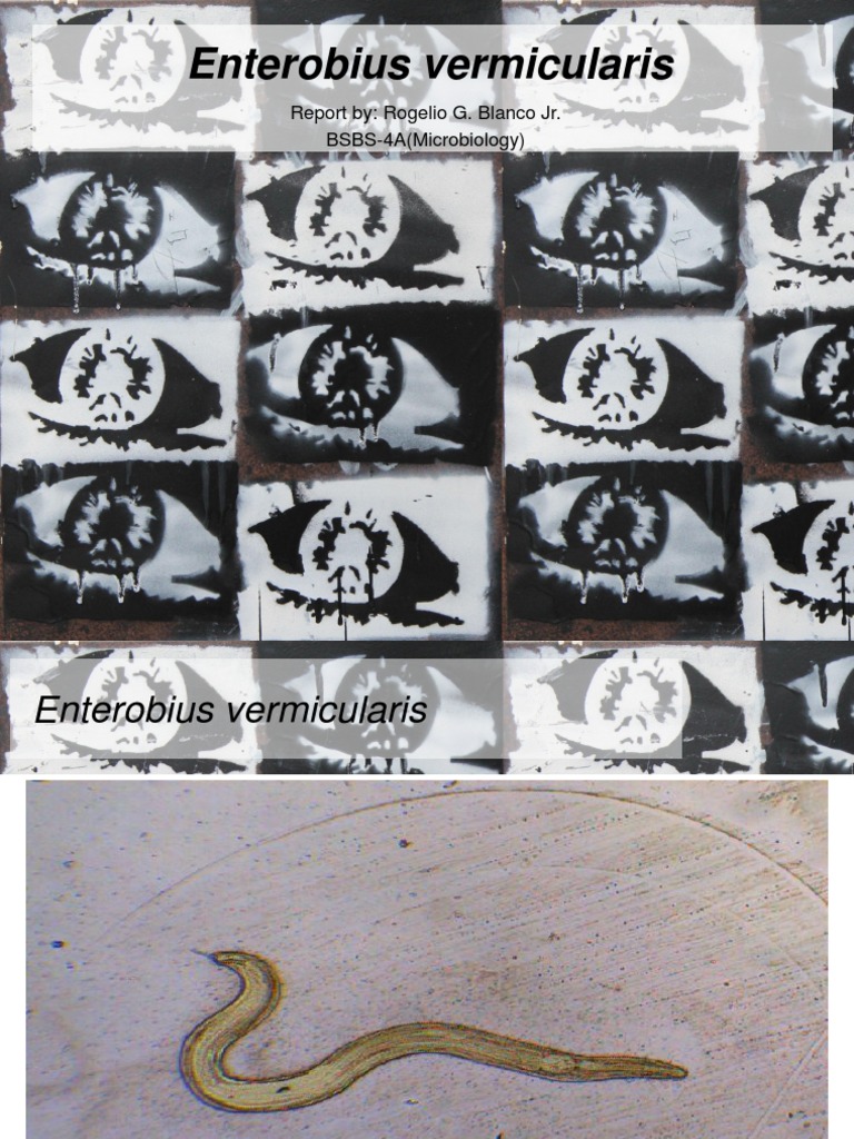 Enterobius Vermicularis | PDF | Clinical Medicine | Medicine