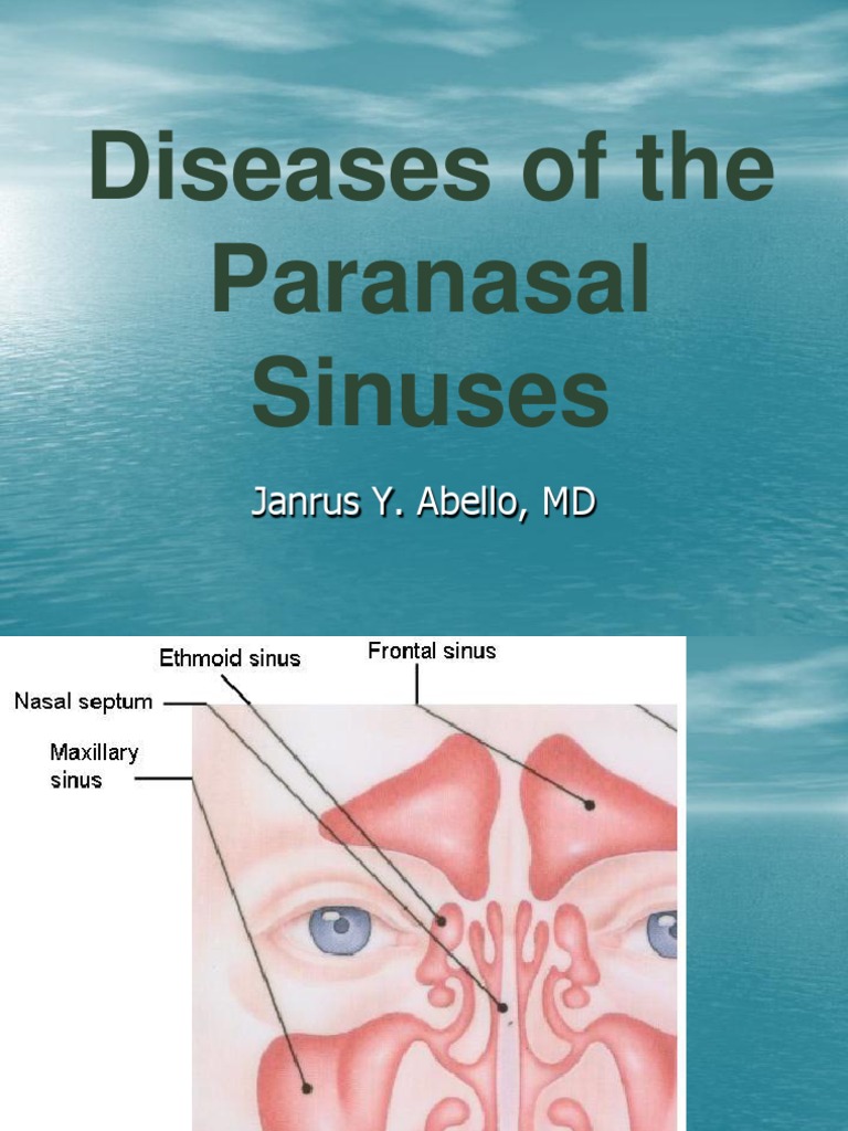 Paranasal Sinus Diseases Overview | PDF | Science & Mathematics