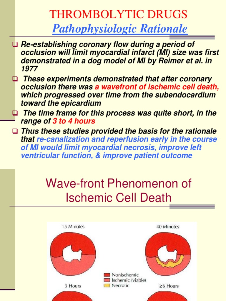 Thrombolytic Drugs 2 | Myocardial Infarction