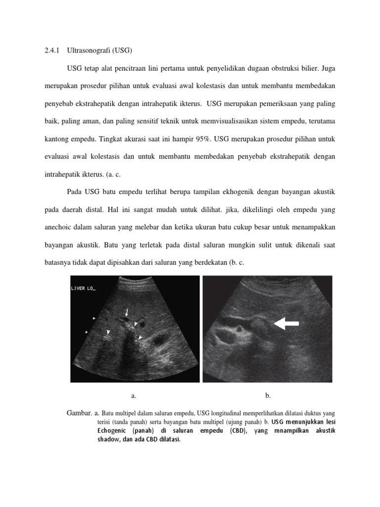 Usg CT Scan Candra Uhgngeri | PDF
