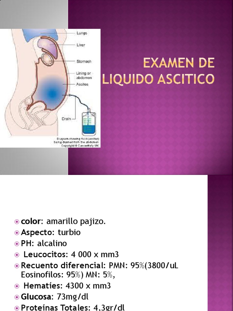 Examen de Liquido Ascitico | PDF