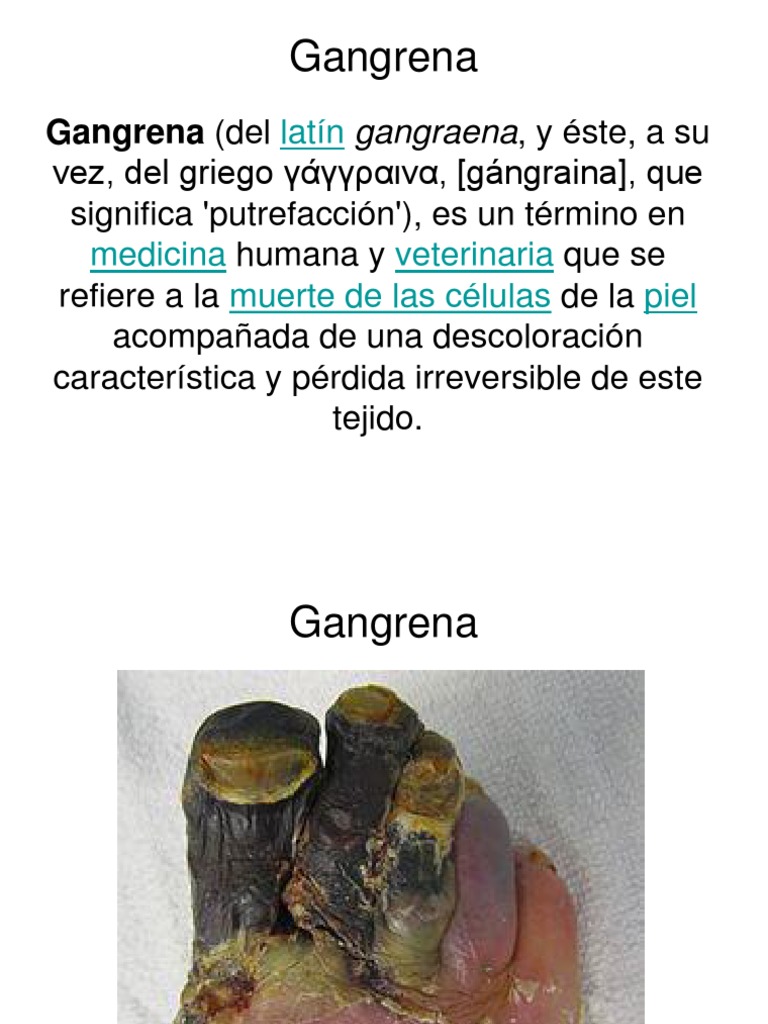 Gangrena Presentación | PDF | Ciencias de la Salud | Medicina CLINICA