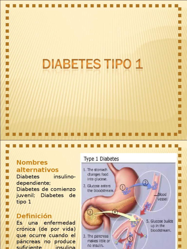 Diabetes Tipo I | PDF | Diabetes mellitus tipo 1 | Diabetes mellitus