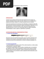 Signos radiológicos del hilio pulmonar | PDF | Pulmón | Corazón