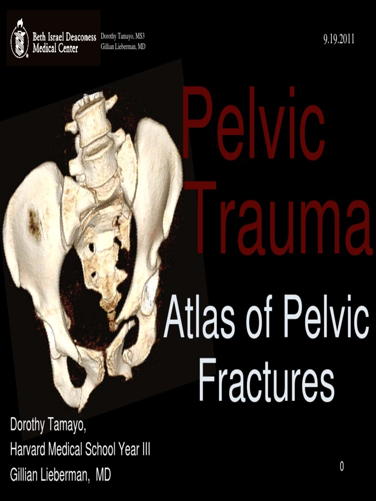 Trauma Pelvic: Atlas of Pelvic Fractures | PDF