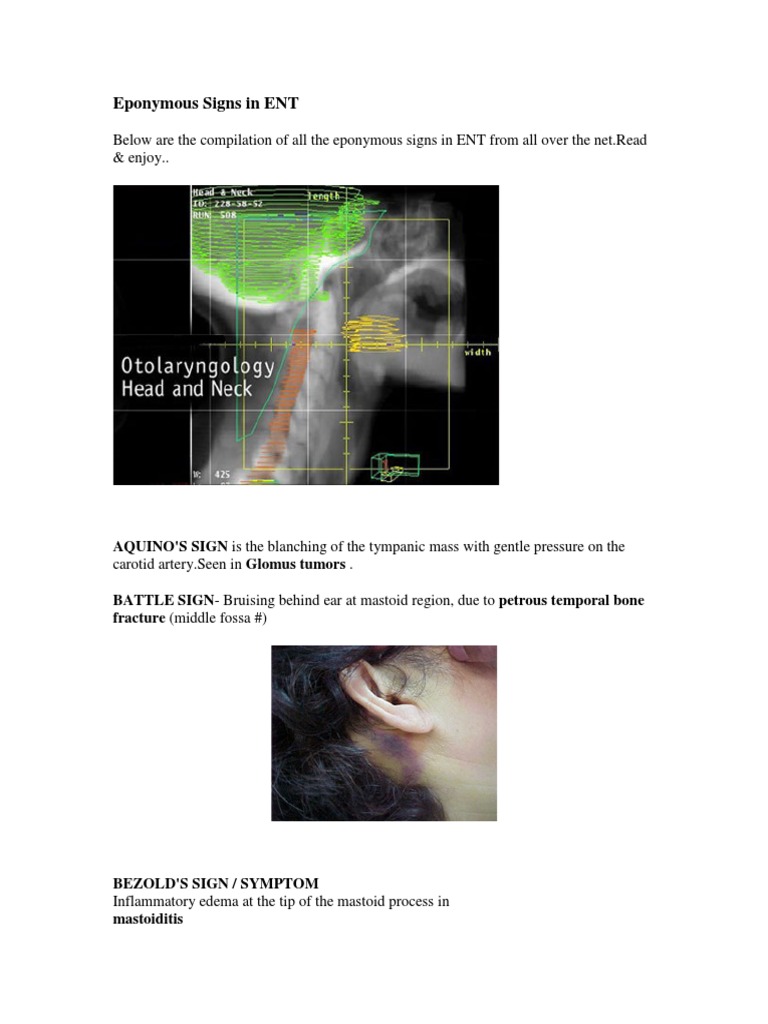 Eponymous Signs in ENT: A Comprehensive List of Clinical Signs Named ...
