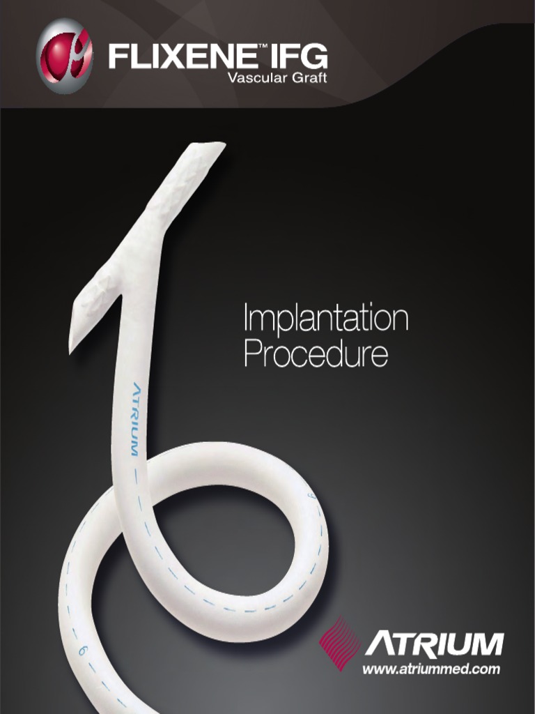 Flixene - IFG - Implantation - Brochure 0341C PDF | PDF | Vein | Arm