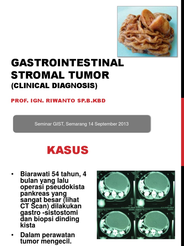 Gist Clinical Diagnosis | PDF | Gastroenterology | Diseases And Disorders