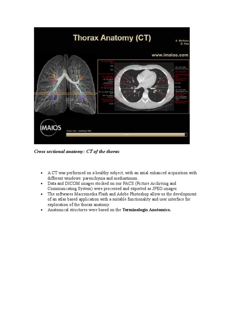 CT Thorax Anatomy Study Guide | PDF | Science & Mathematics
