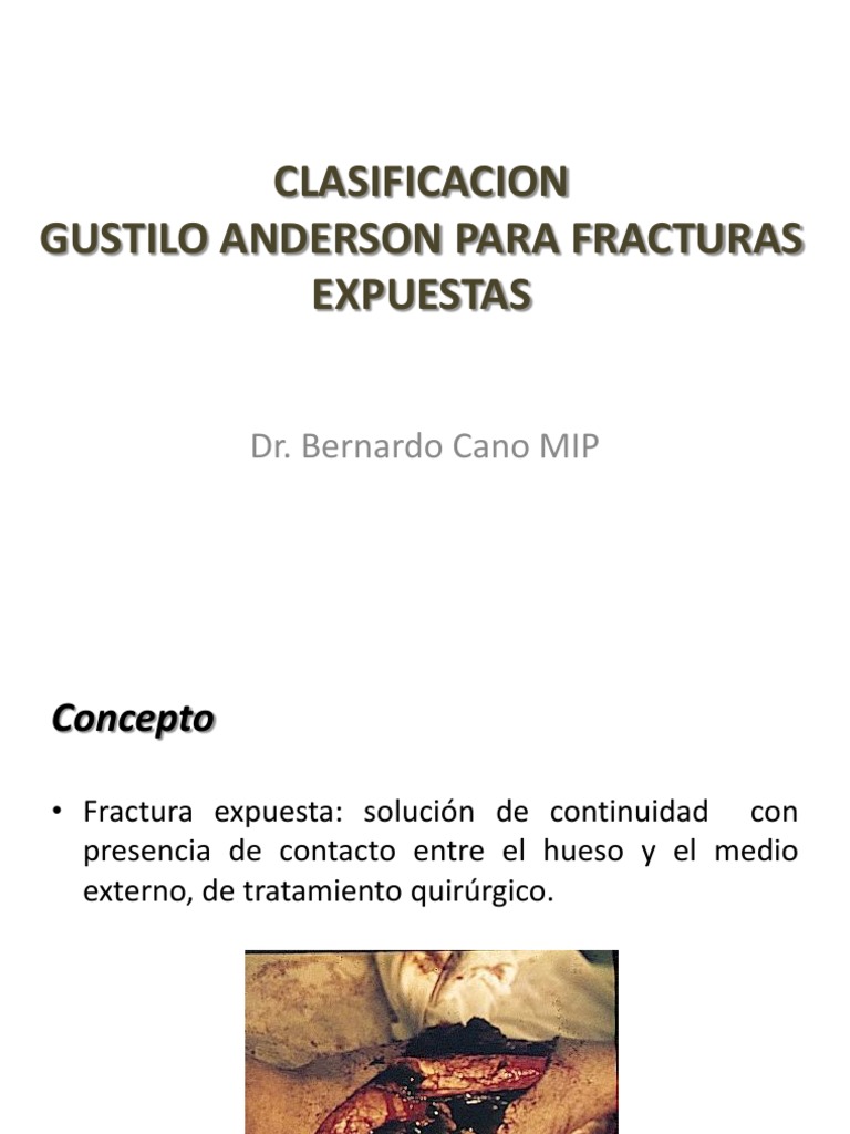 CLASIFICACION GUSTILO | Anatomía humana | Medicina CLINICA