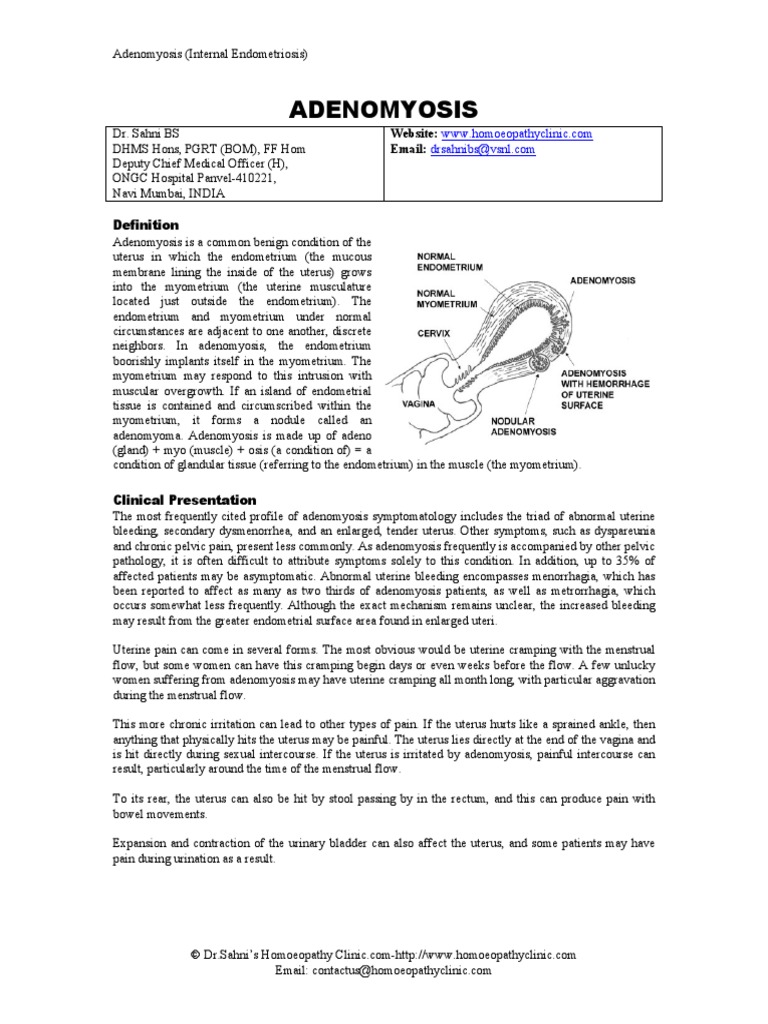 adenomyosis | Uterus | Menstruation