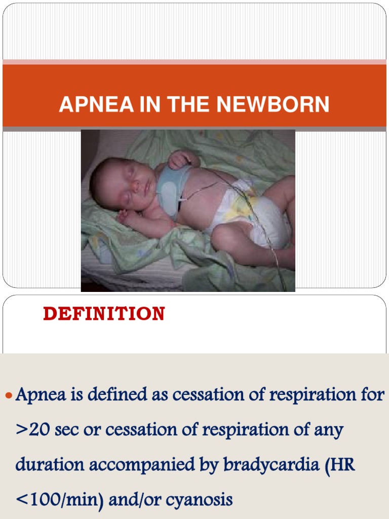 Apnea in The Newborn | PDF | Apnea | Respiratory Tract