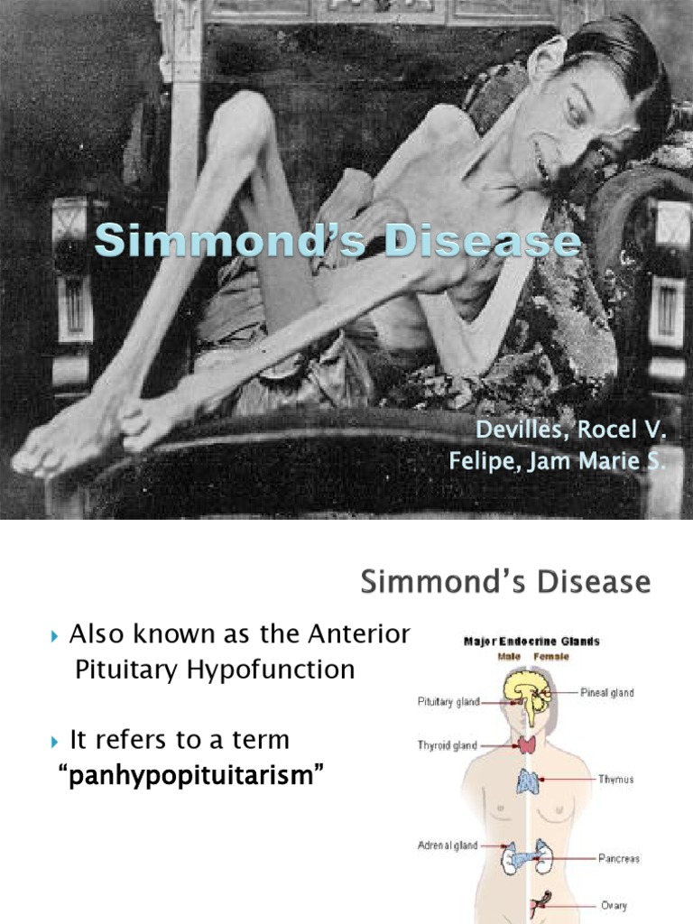 Simmond's Disease MS | PDF | Organ (Anatomy) | Endocrine System