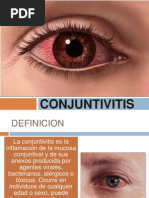 GPC #06 - CONJUNTIVITIS AGUDA - Feb 2022 | PDF | Alergia | Enfermedades ...