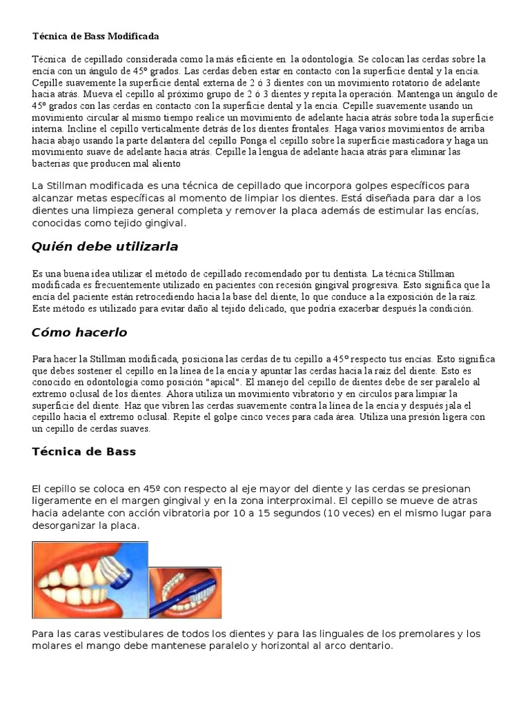 Técnica de Bass Modificada | Diente | Odontología | Prueba gratuita de ...