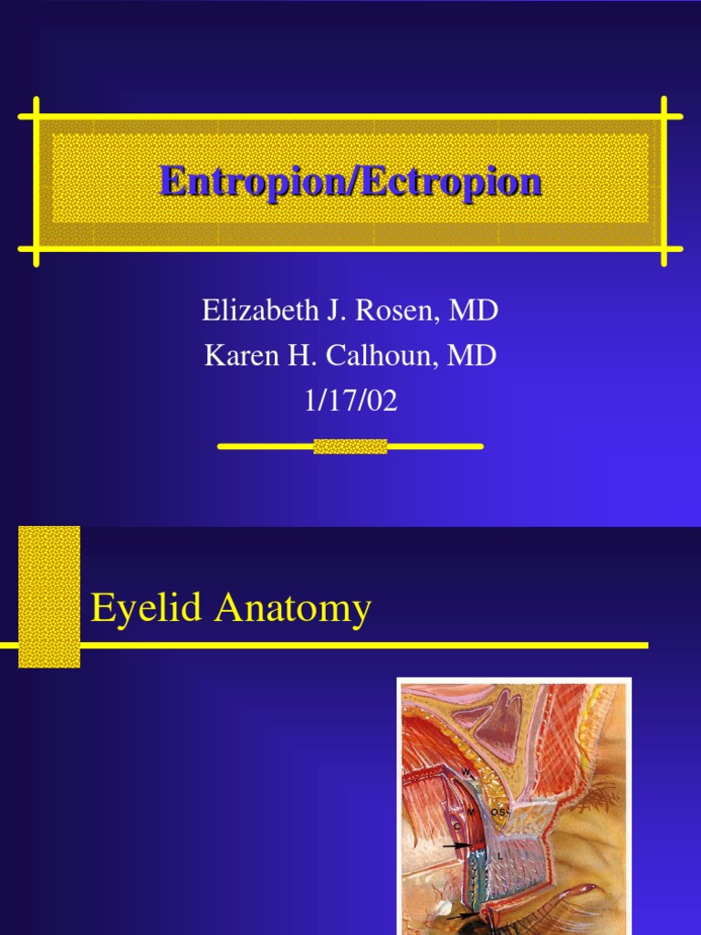 Ectropion | PDF | Human Anatomy | Primate Anatomy