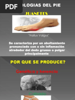 Pie Talo, Pie Varo, Valgo, y Pie Plano | PDF | Pie | Tobillo