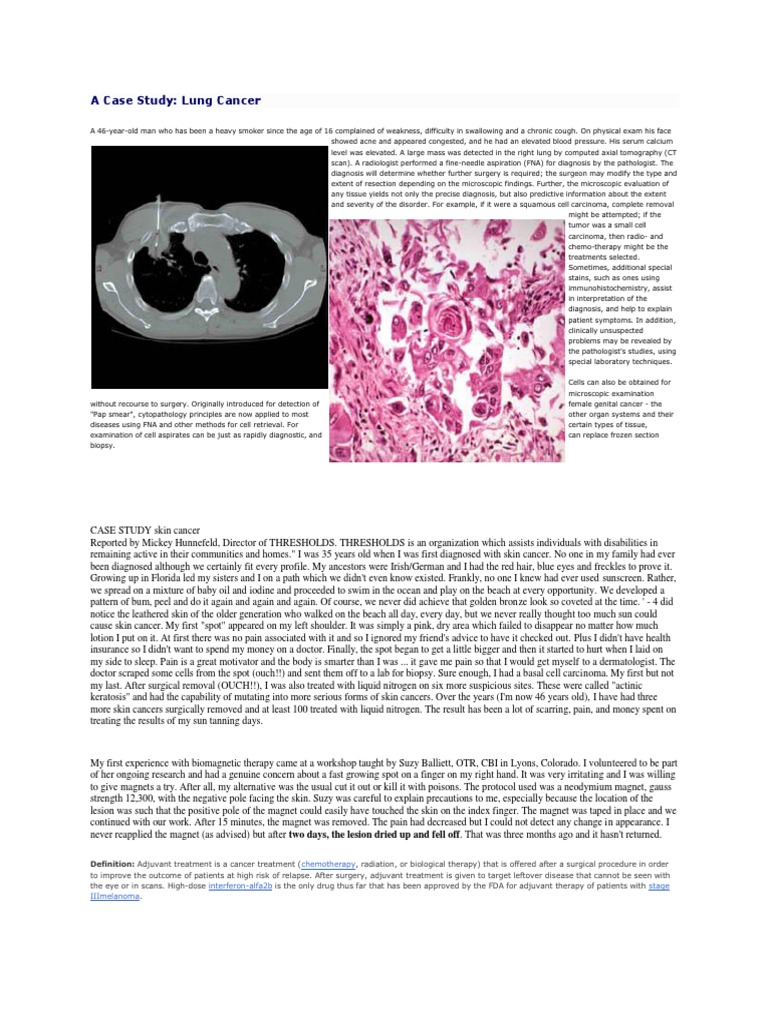 A Case Study | PDF | Pathology | Cancer