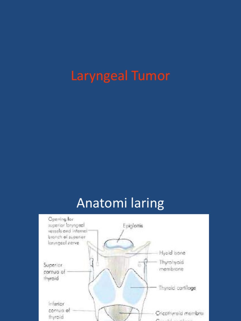 A Comprehensive Review of Benign and Malignant Laryngeal Tumors ...