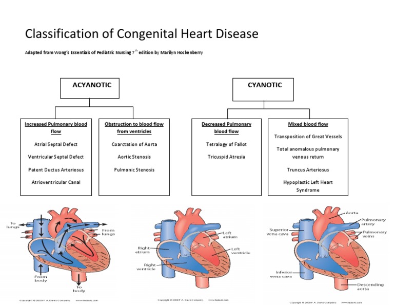 Classification of Congenital Heart Disease | PDF | Congenital Heart ...
