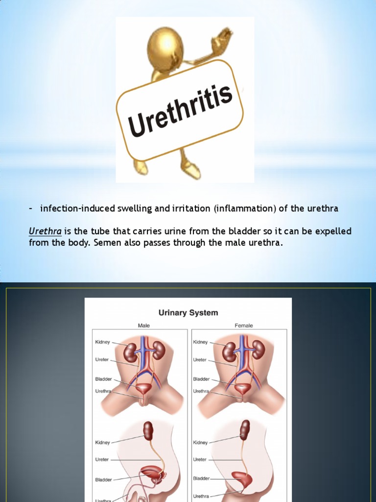 Urethritis | PDF | Urinary Tract Infection | Urology
