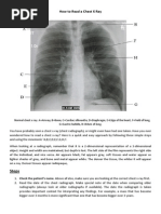 Normal CT Chest Anatomy Overview | PDF | Ct Scan | Diseases And Disorders