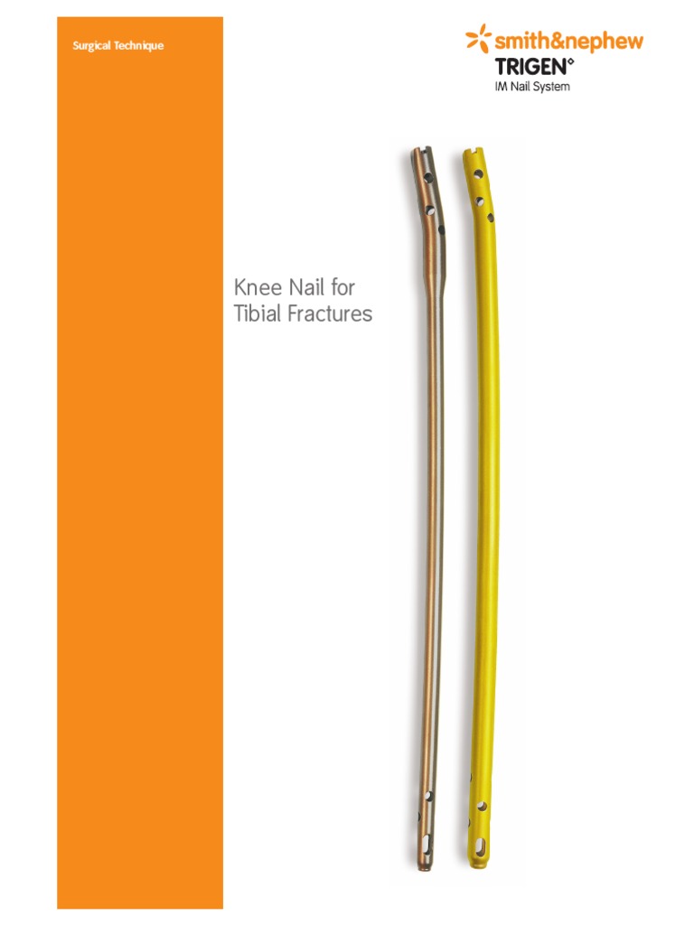 Knee Nail For Tibial Fractures: Surgical Technique | PDF | Screw | Knee