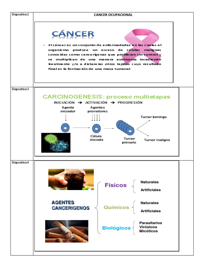 AGENTES CANCERIGENOS | Amianto | Carcinógeno