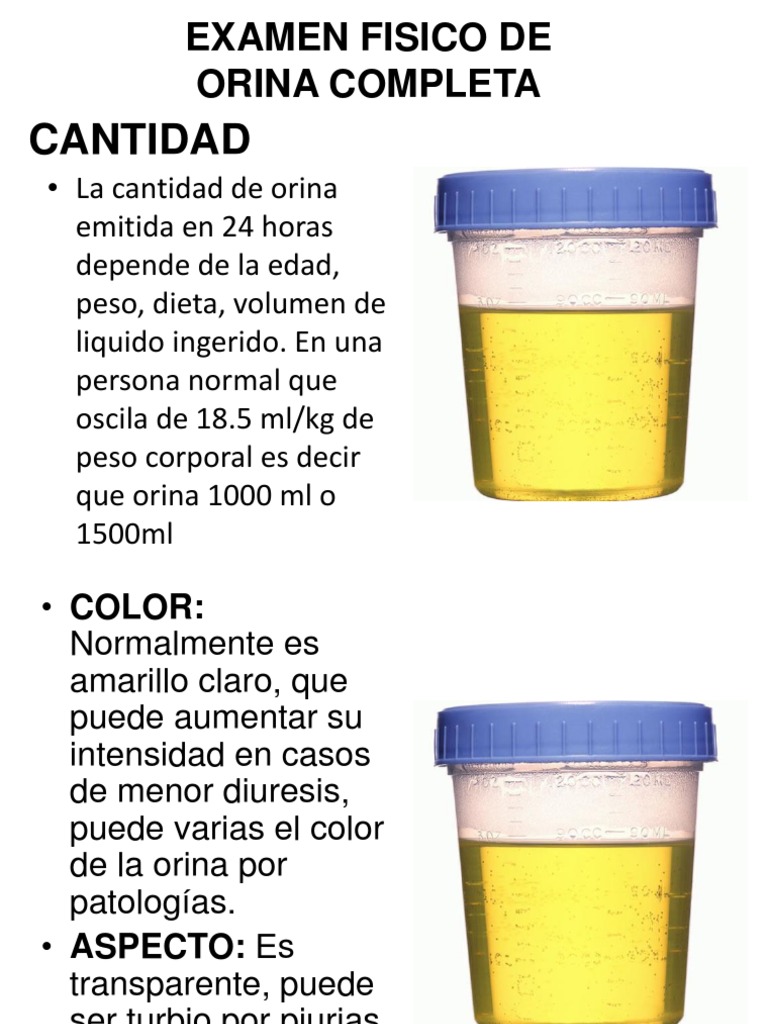 Orina | PDF | Orina | Especialidades Medicas