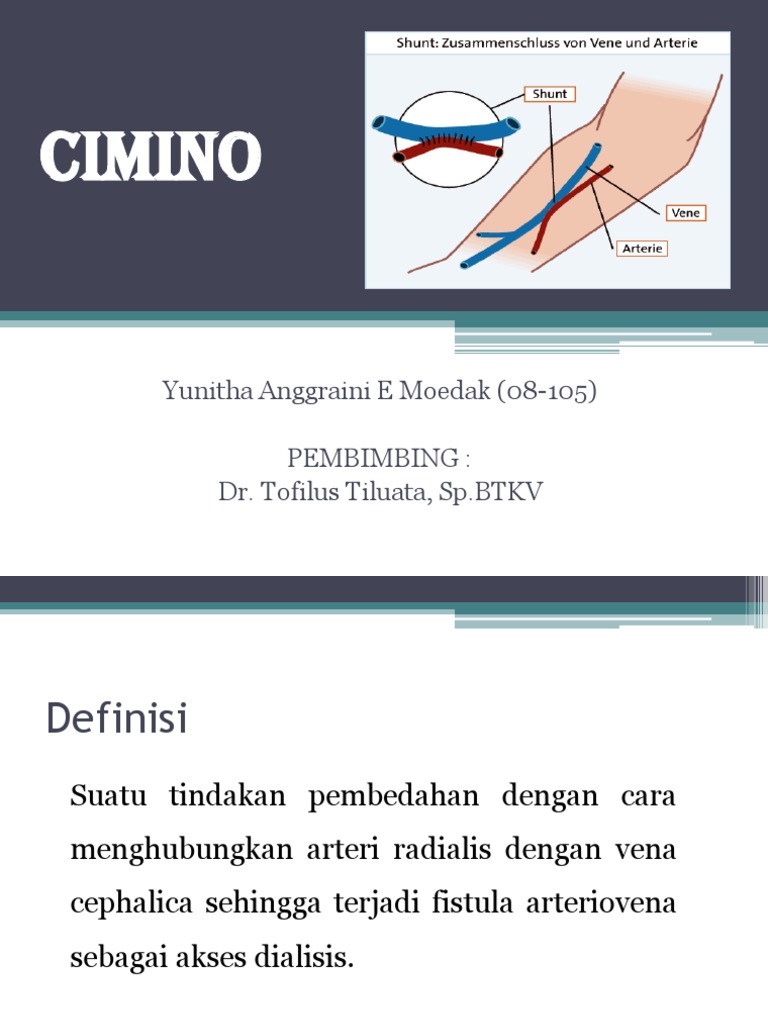 Cimino | PDF