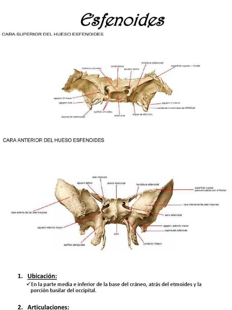 esfenoides