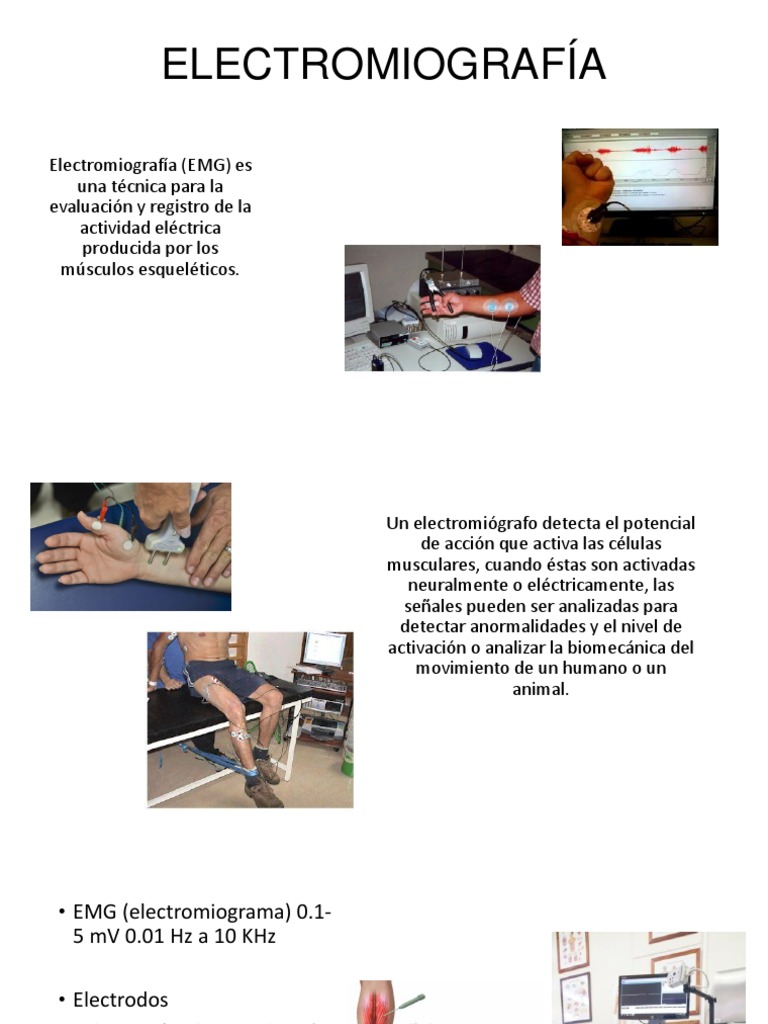 Electromiografía | PDF | Electromiografia | Anatomía