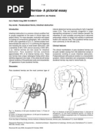 The Toldt Fascia | PDF | Abdomen | Digestive System
