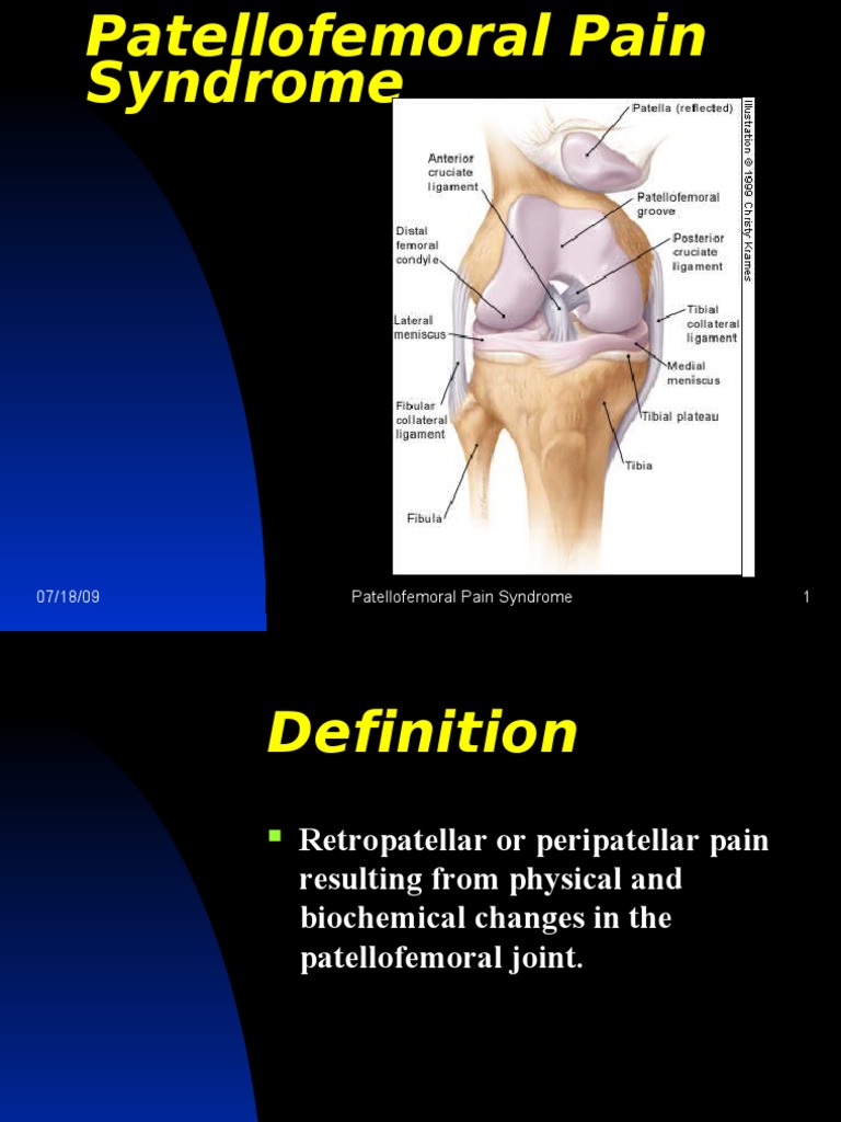 Patellofemoral Pain Syndrome Overview | PDF | Knee | Musculoskeletal System