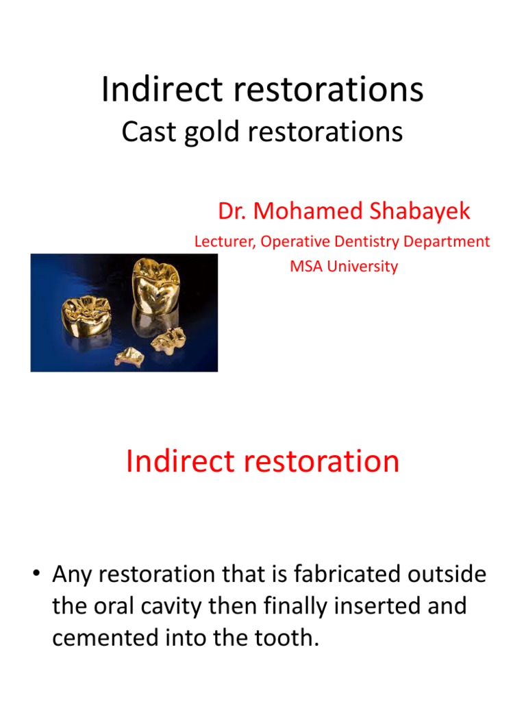 Indirect restorations | Dentistry Branches | Materials