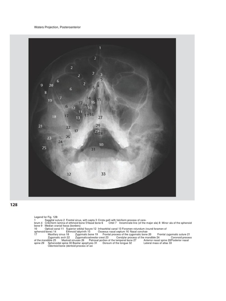 Waters Projection in Skull Imaging | PDF