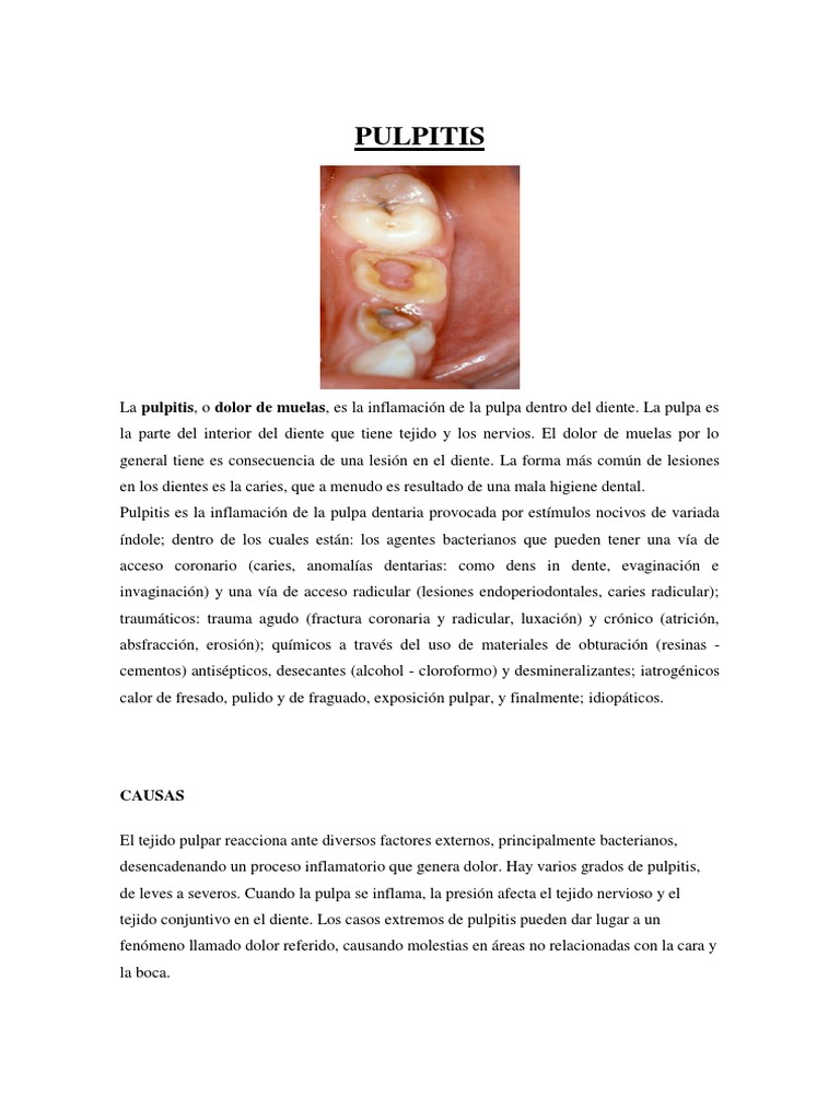 Pulpit Is Ss | PDF | Inmunología | Odontología
