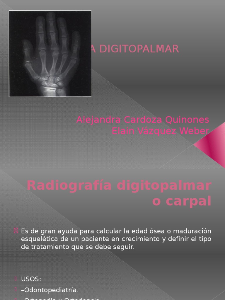 RADIOGRAFIA DIGITOPALMAR | Mano | Anatomía humana